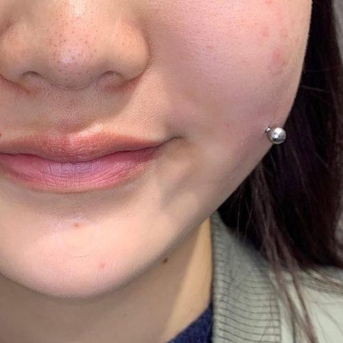 Use Cheek Piercing To Add Charming Dimples To Your Look