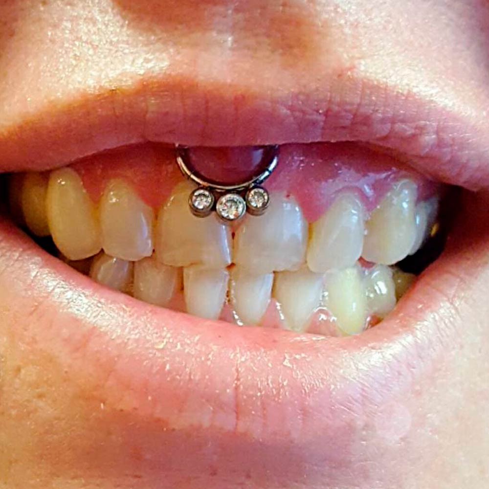 Smiley Piercing Guide To Get A Mouth Piercing - Glaminati