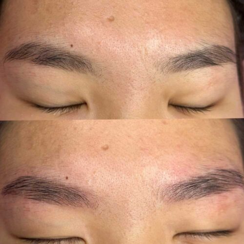 Expert Guide to Permanent Makeup Removal Techniques