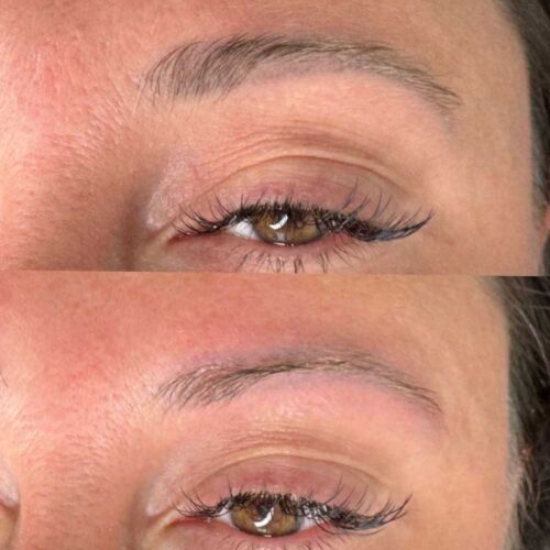 Expert Guide to Permanent Makeup Removal Techniques